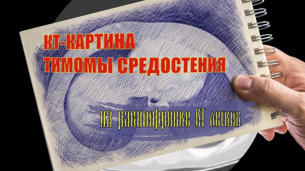 КТ картина ОБРАЗОВАНИЯ СРЕДОСТЕНИЯ (вероятно тимома) на РАСШИФРОВКЕ КТ ...