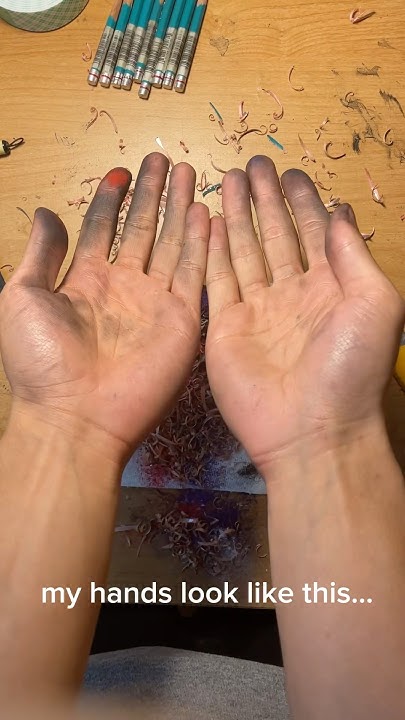 My Hands Look Like This Because… - YouTube