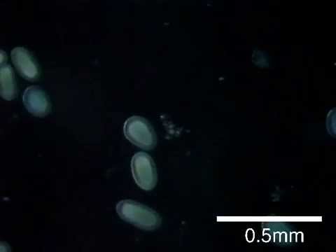 Planula larva of Aurelia sp. - YouTube