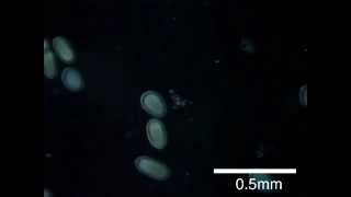 Aurelia Planula Larva