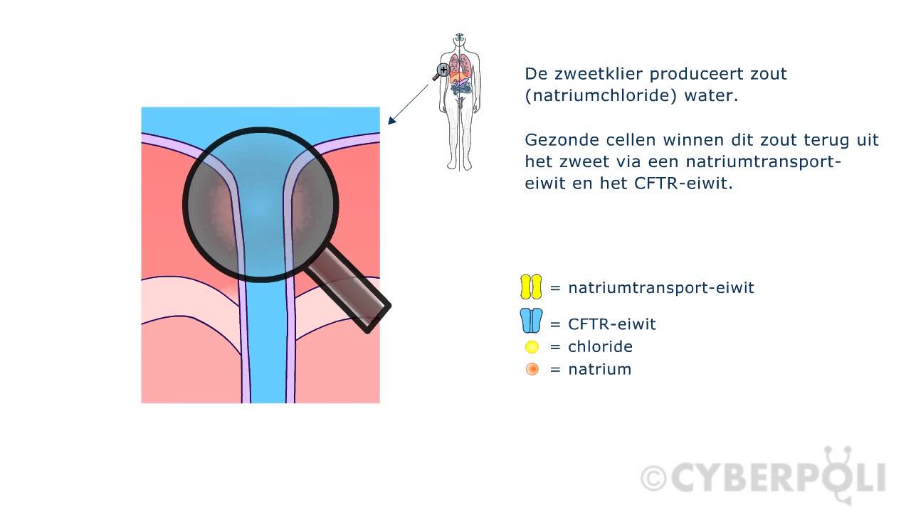 Wat doet CF in de zweetklieren? - YouTube