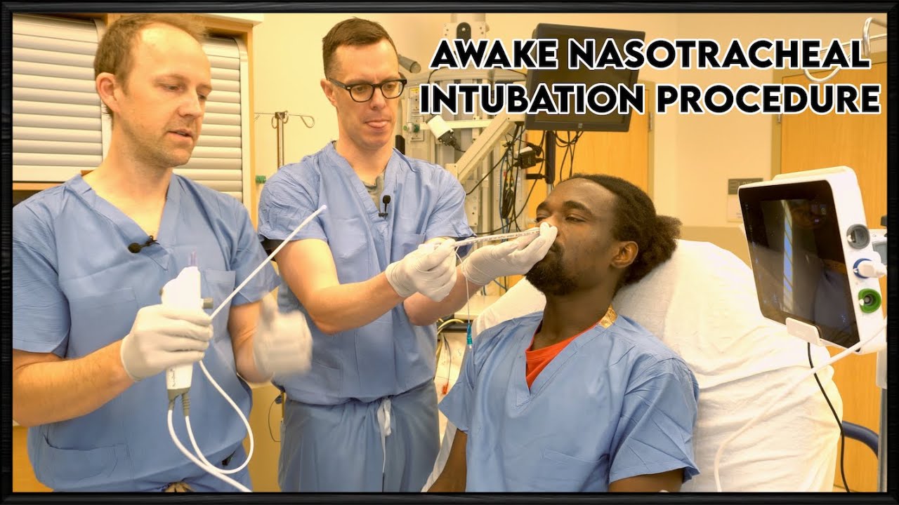Awake Intubation Nasal Approach - YouTube