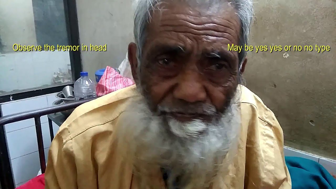 Essential Tremor in Head and Hand - YouTube