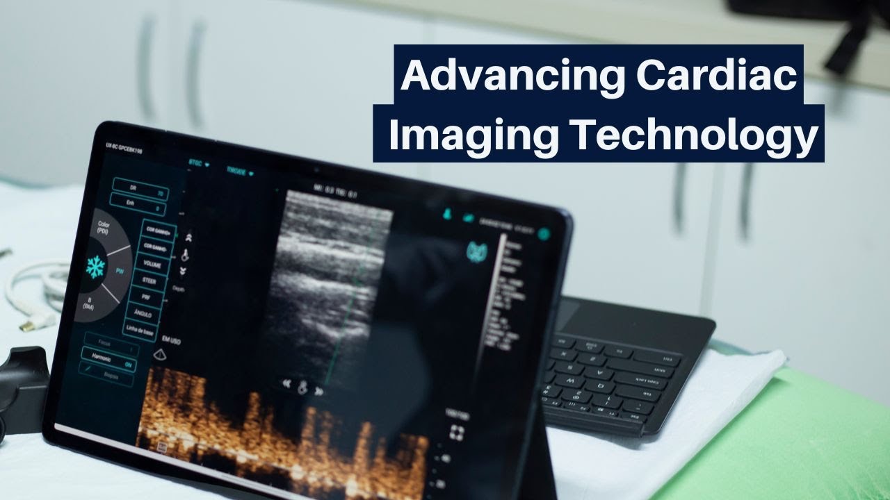 Advancing Cardiac Imaging Technology - YouTube
