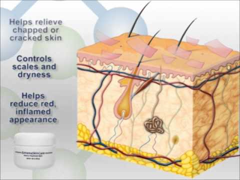 Psoriasis & Eczema Treatment Animation - YouTube