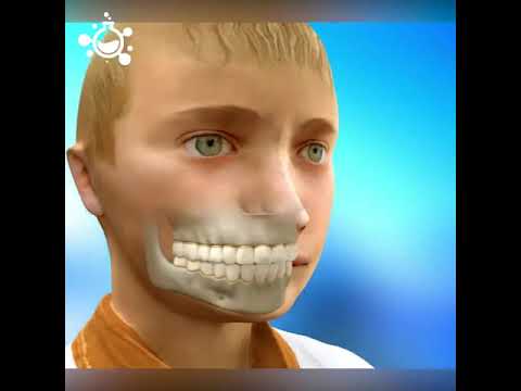 Dental and Corrective Jaw Surgeries Animation | Orthognathic | Surgical ...