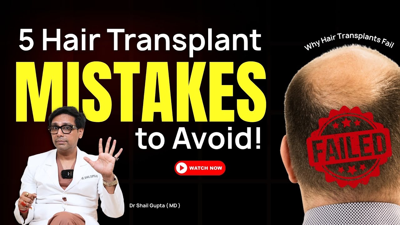 5 Reasons Why Hair Transplants Fail | Dr. Shail Gupta Explains the ...