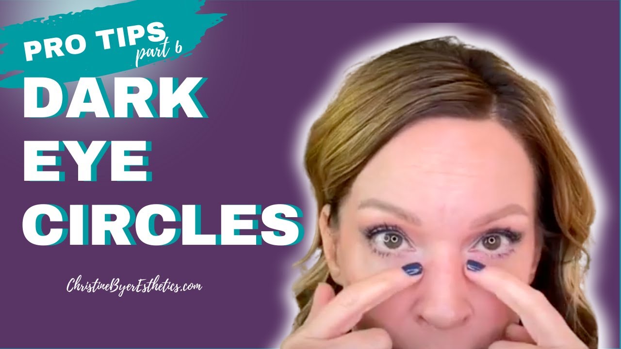 Under eye circles, broken capillaries Your questions part 6 - YouTube