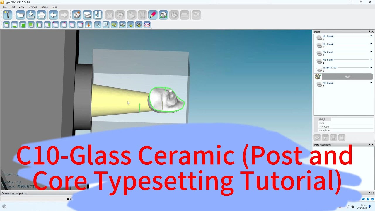 C10-Glass Ceramic (Post and Core Typesetting Tutorial) - YouTube