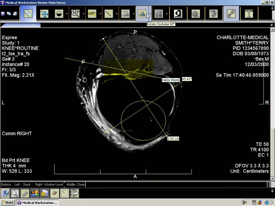 LEADTOOLS DICOM Data Set Medical Workstation Viewer - YouTube