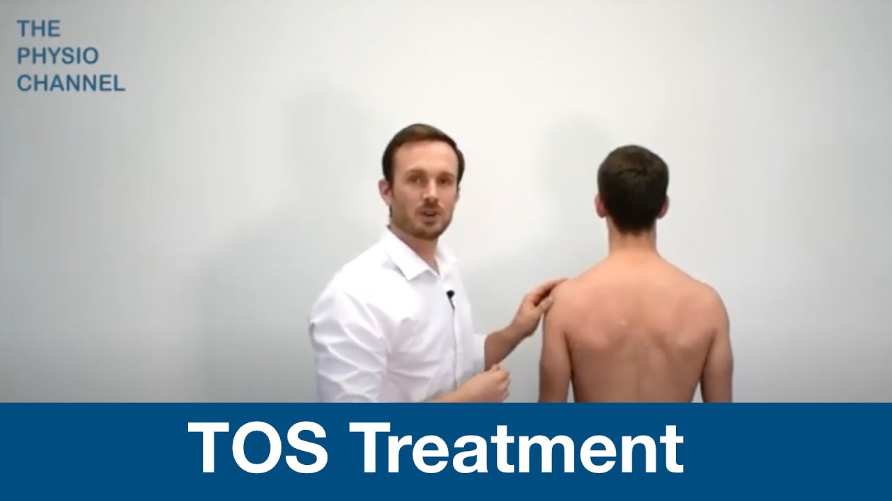 How to Treat Thoracic Outlet Syndrome with stretches and exercises ...