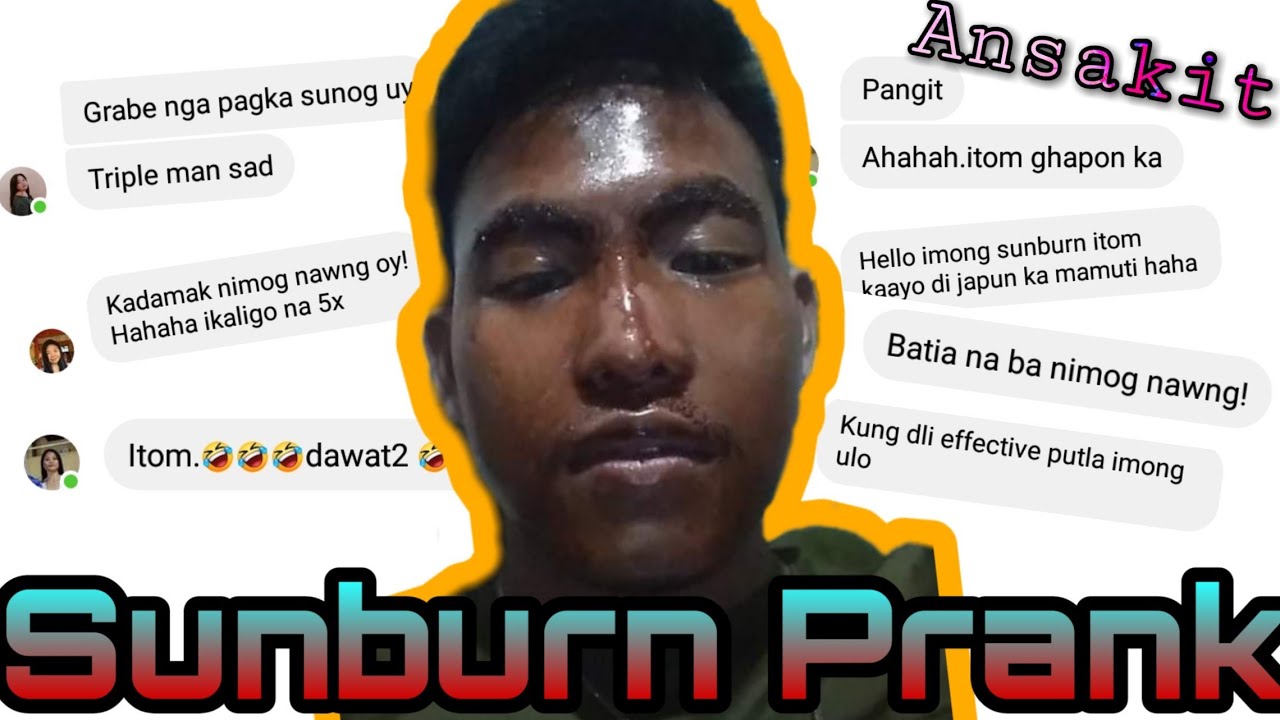 Laptrip Part1 😂 | SunBurn Prank - YouTube