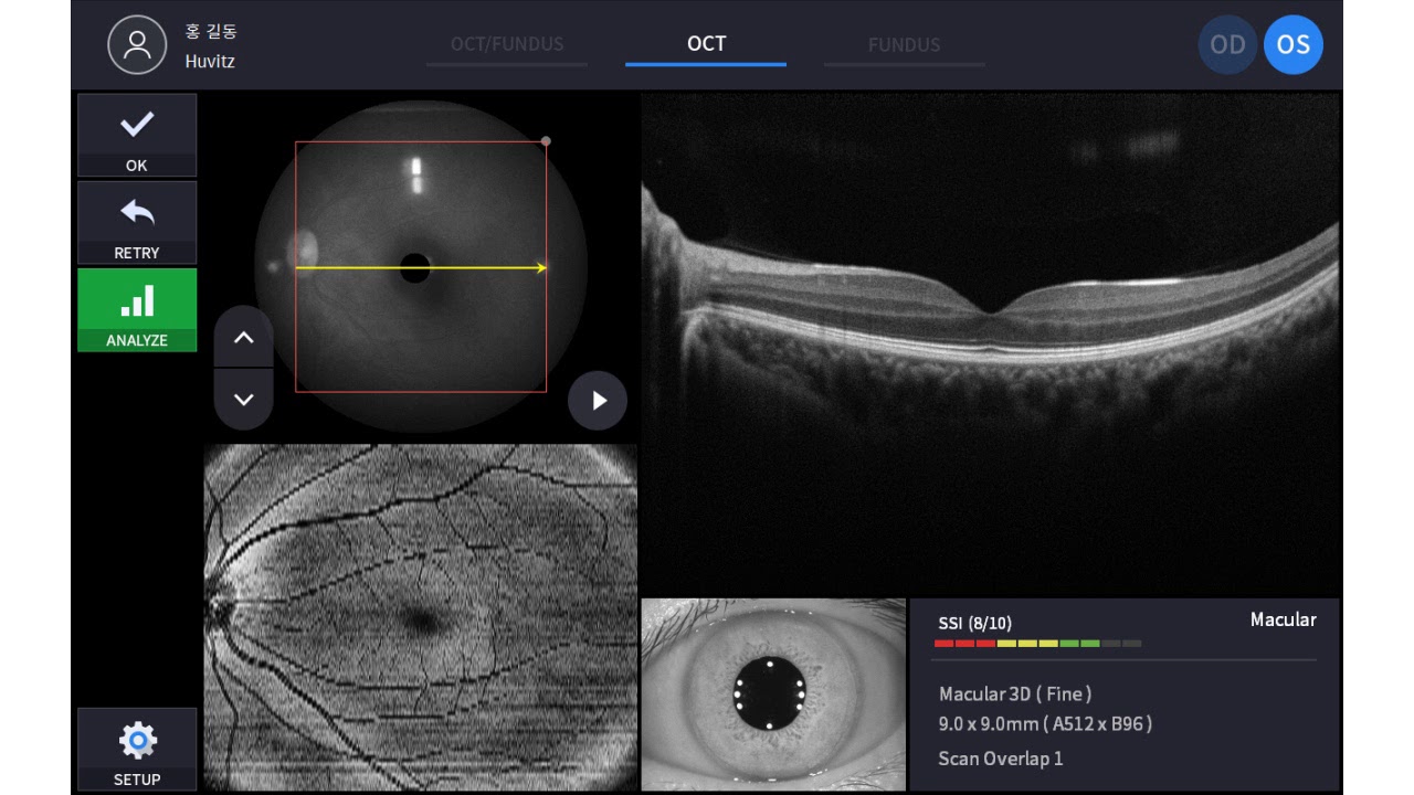 Huvitz All-in-One OCT HOCT-1F - YouTube