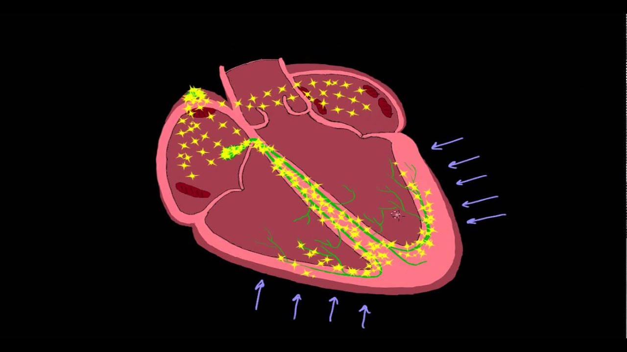 Heart Block Pathophysiology YouTube Heart Block Pathophysiology YouTube