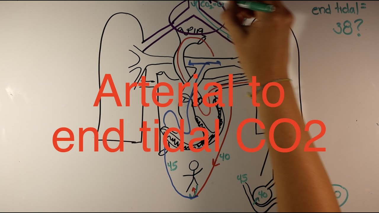 End tidal to arterial CO2 difference in CHD - YouTube