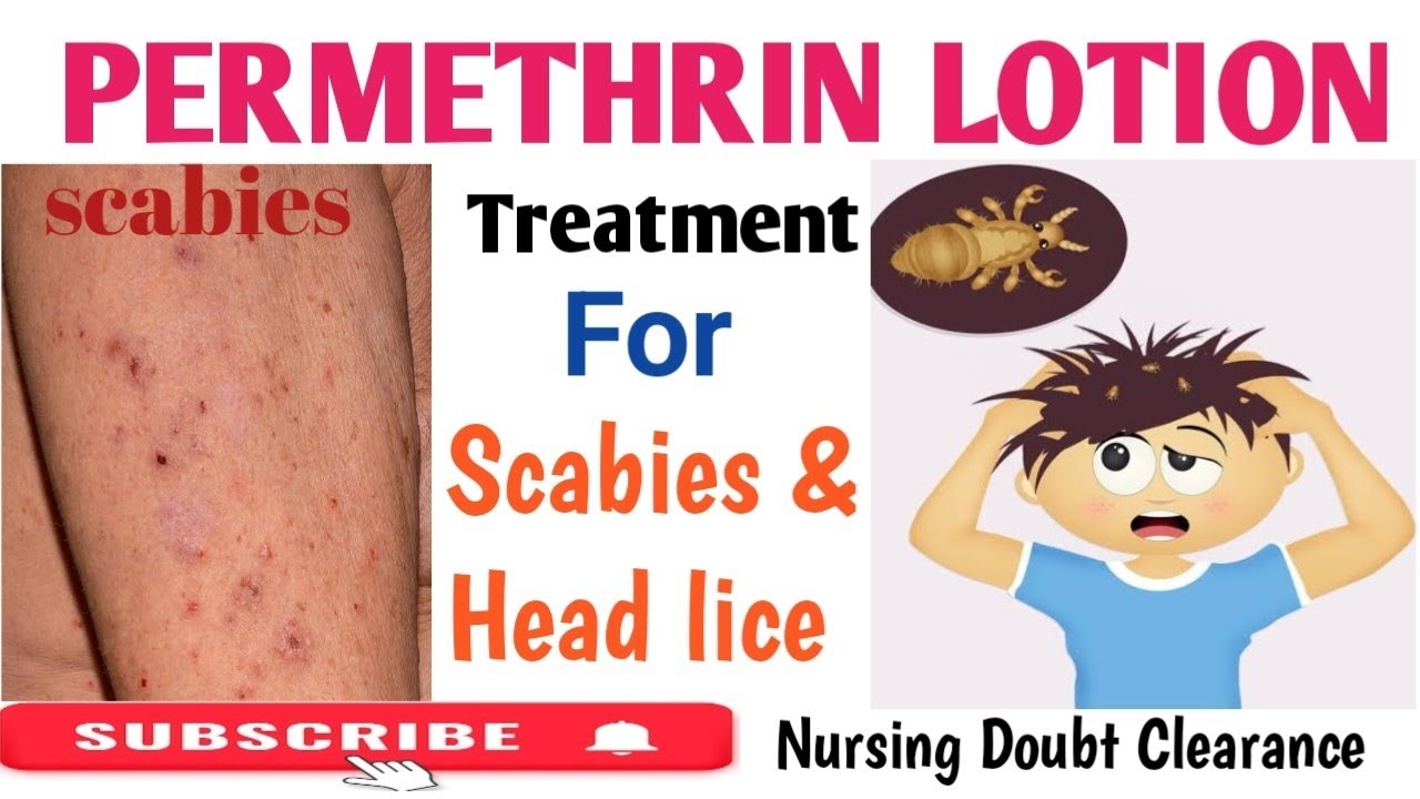 Permethrin Lotion Uses For Lice and Scabies | How to Apply Permethrin ...