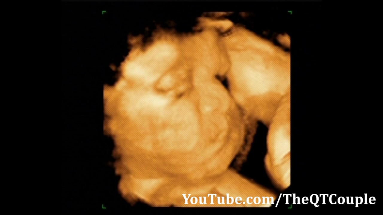 4D Ultrasound @ 30 Weeks - YouTube