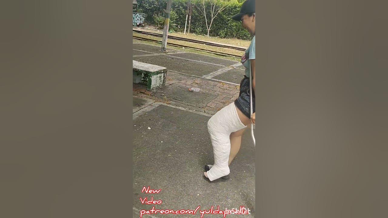 Long Leg Cast Girl Llc 2 Youtube