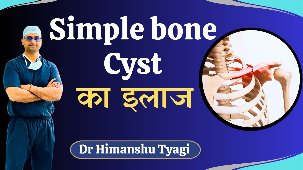 Simple Bone Cyst का इलाज | - YouTube