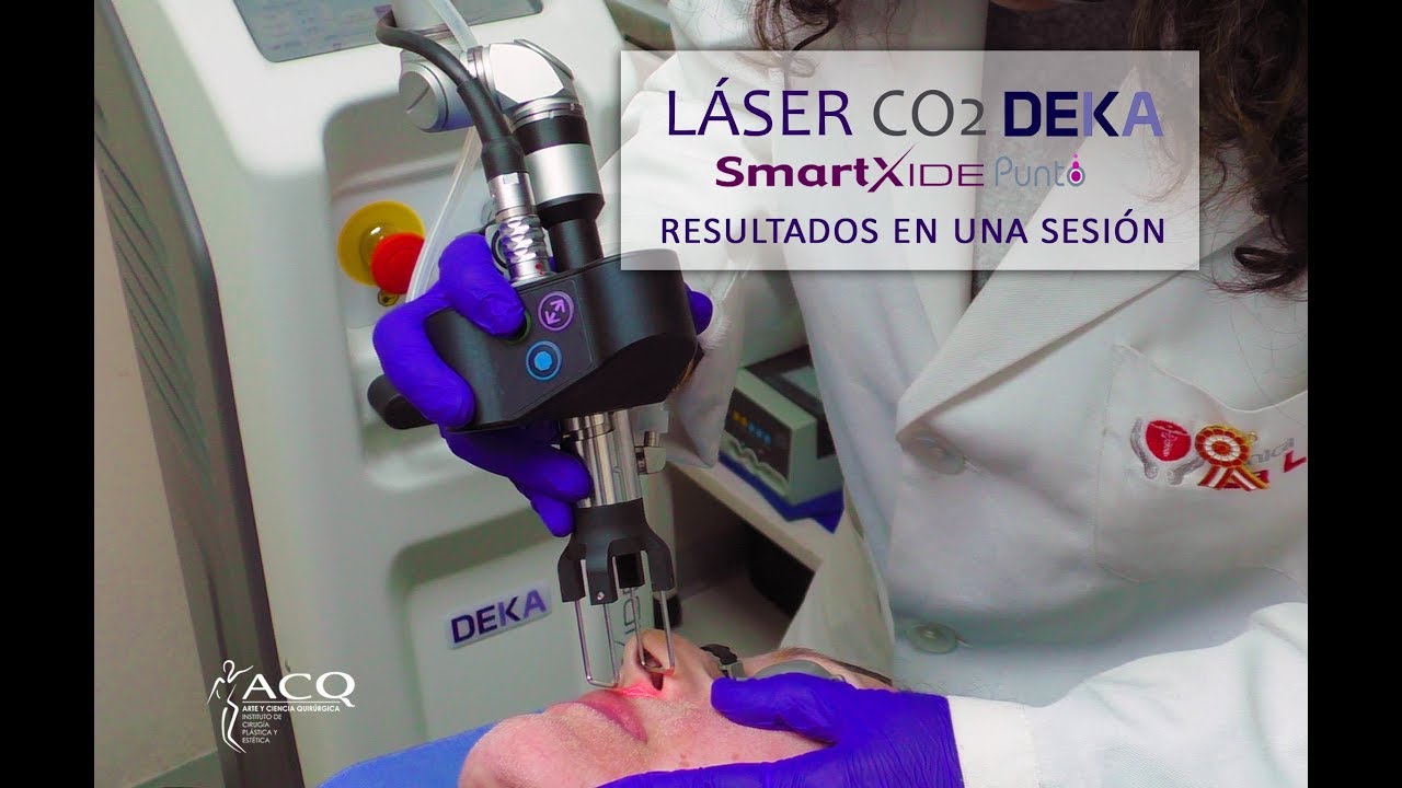 Láser CO2 Deka - Rejuvenecimiento Facial - Dr. #AlbertoCalvo - YouTube