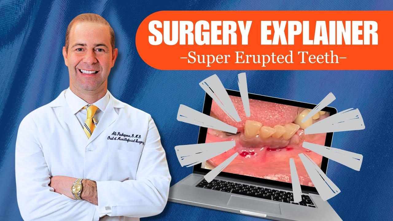Super Erupted Teeth? I can fix that... - YouTube