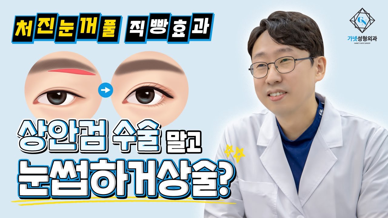 처진눈꺼풀에 직빵 눈썹하거상술 수술방법│회복기간│흉터│추천 연령│상안검과의 차이까지🙋♂️ Youtube