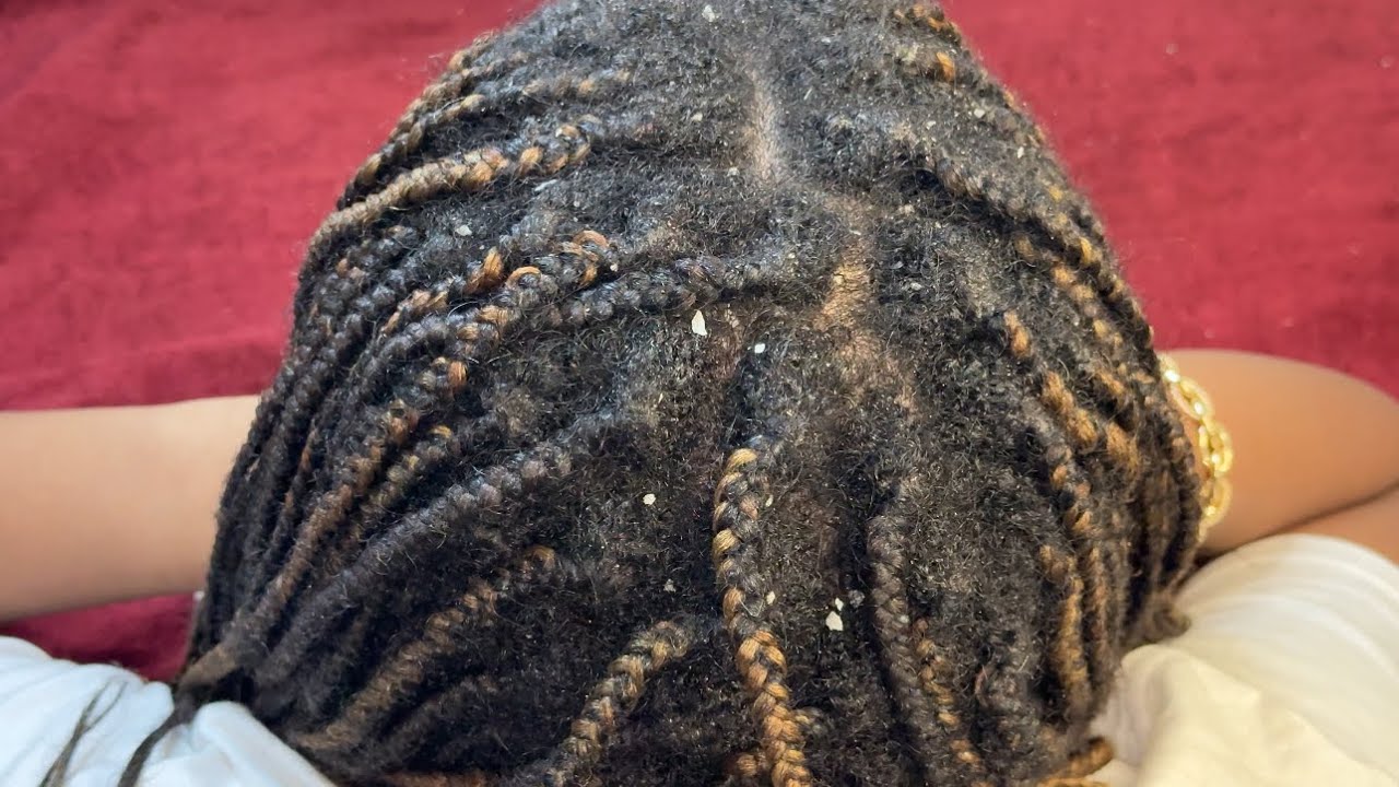 ASMR Scalp Scratching Session | Dry, Flaky Scalp • Comb, Fingernails ...
