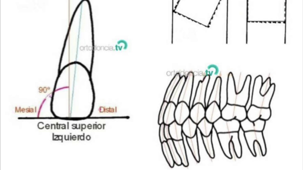 Las 6 llaves de la oclusión normal - YouTube