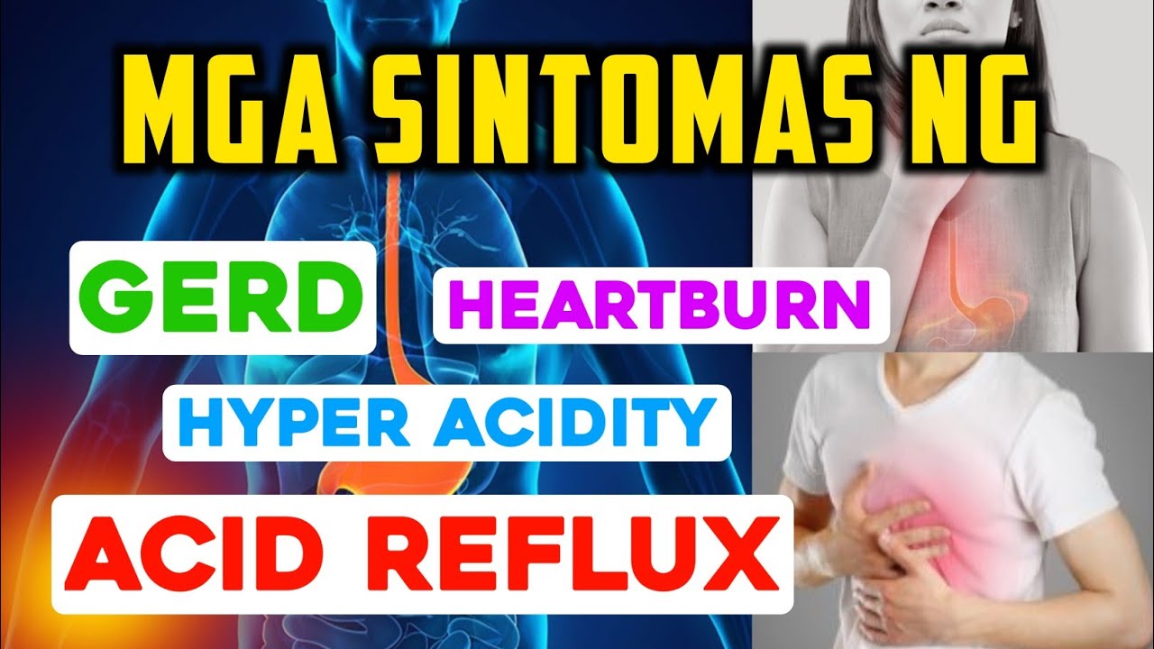 Mga Sintomas ng Gerd,Hyper Acidity,Heartburn! | Kuya Jimz - YouTube