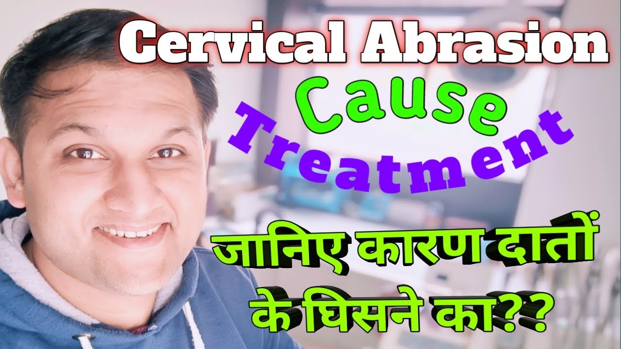Tooth Cervical Abrasion: Causes, Treatment and prevention|| What is ...