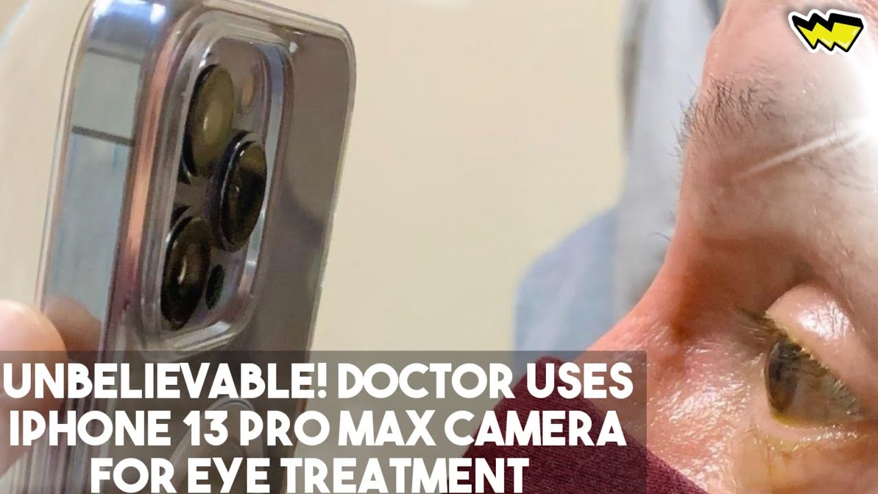 Unbelievable! Doctor uses iPhone 13 Pro Max camera for eye treatment ...