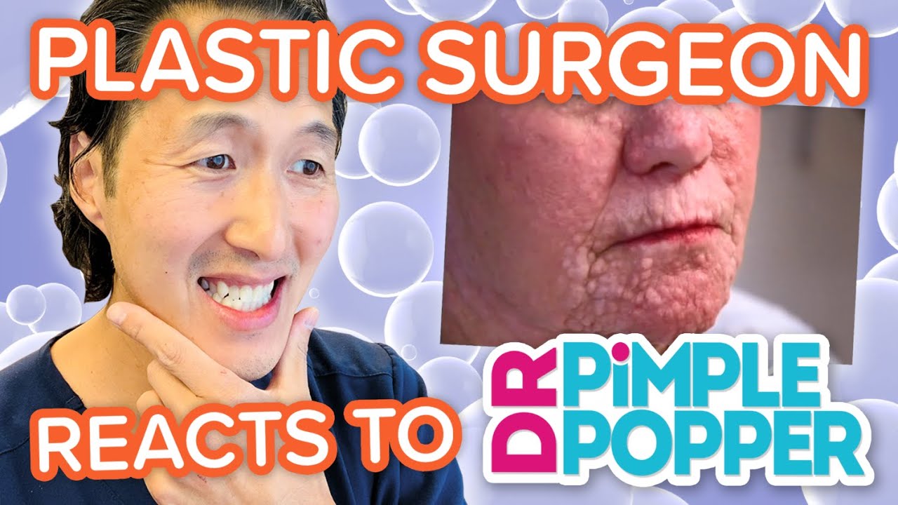 Plastic Surgeon Reacts to DR. PIMPLE POPPER: Severe Neurofibromatosis ...