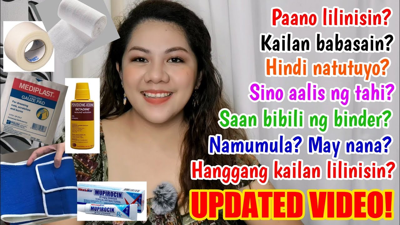 Paano Linisin ang Sugat ng CS Updated Video | Madalas na mga Tanong ng ...