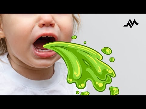 Vomiting and Fever in a 1-year-old girl - Case Report