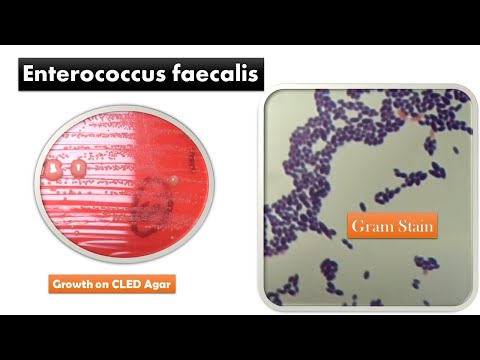 Enterococcus Faecium Gram Stain