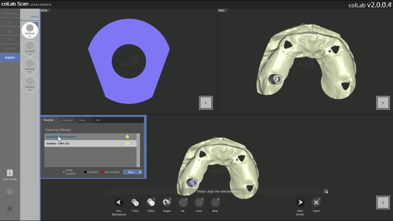 33f Advanced scan body alignment - YouTube