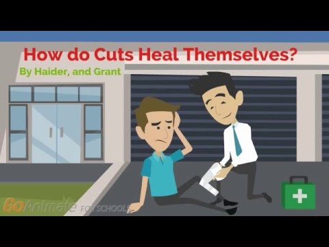 How Do Cuts Heal themselves? By Haider And Grant - YouTube