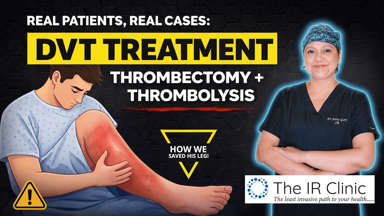 DVT (Blood Clot) Treated LIVE 🚨 | Treatment Explained (Step-by-Step ...
