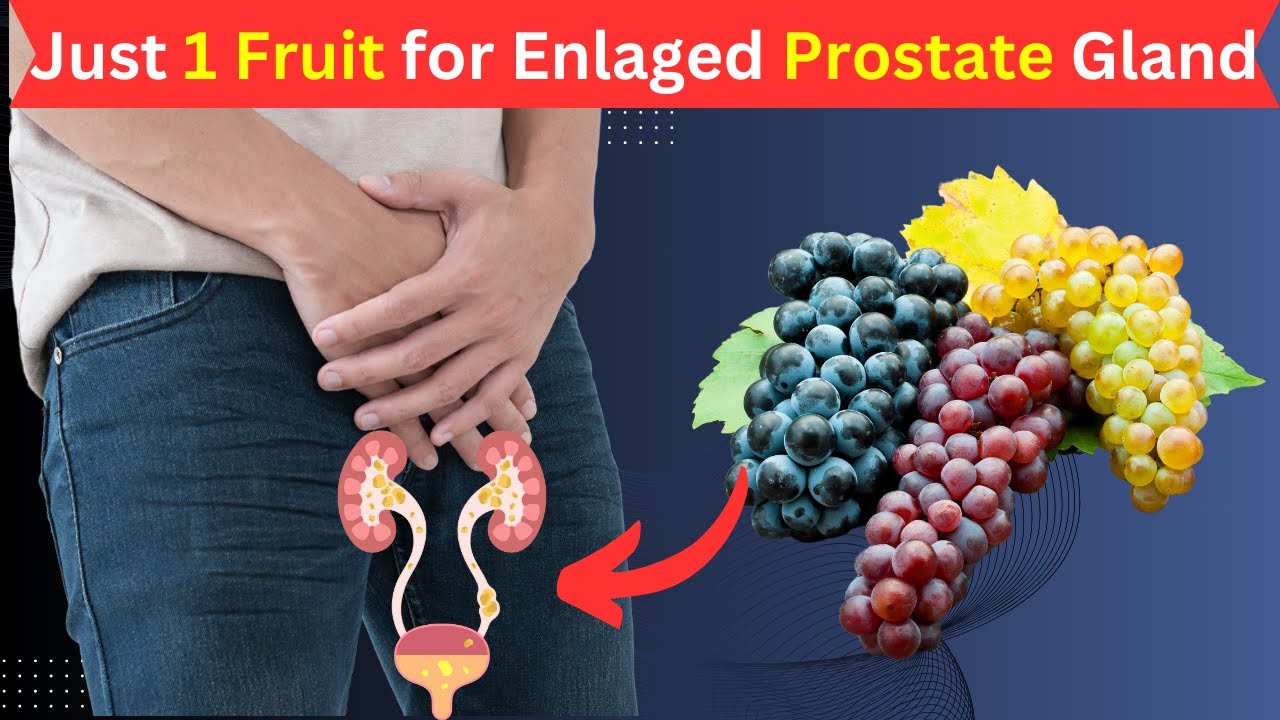 Just 1 Fruit to SHRINK your Enlarged Prostate in 30 Days | Top 10 ...