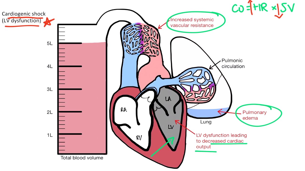Shock for the USMLE Step 1 - YouTube