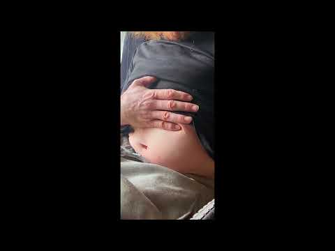 Belly Play 2 (My Disabled Belly!)