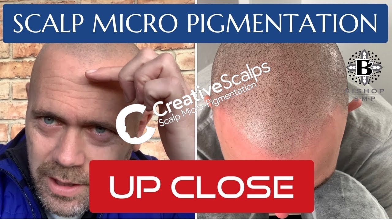 Scalp MicroPigmentation UP-CLOSE | Creative Scalps - YouTube