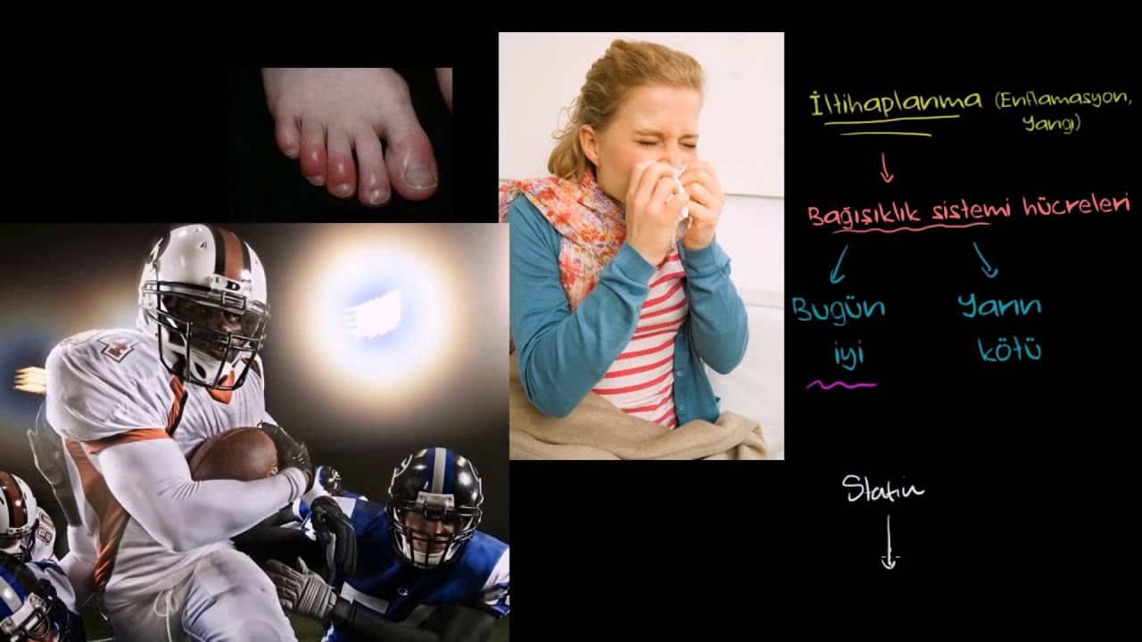 İltihaplanma (Enflamasyon) (Fen Bilimleri)(Sağlık ve Tıp) - YouTube