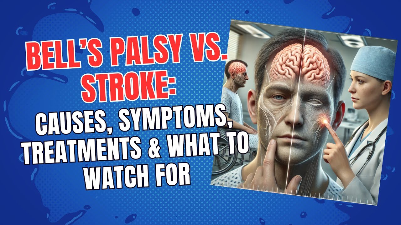Bell’s Palsy vs. Stroke: Causes, Symptoms, Treatments & What to Watch ...