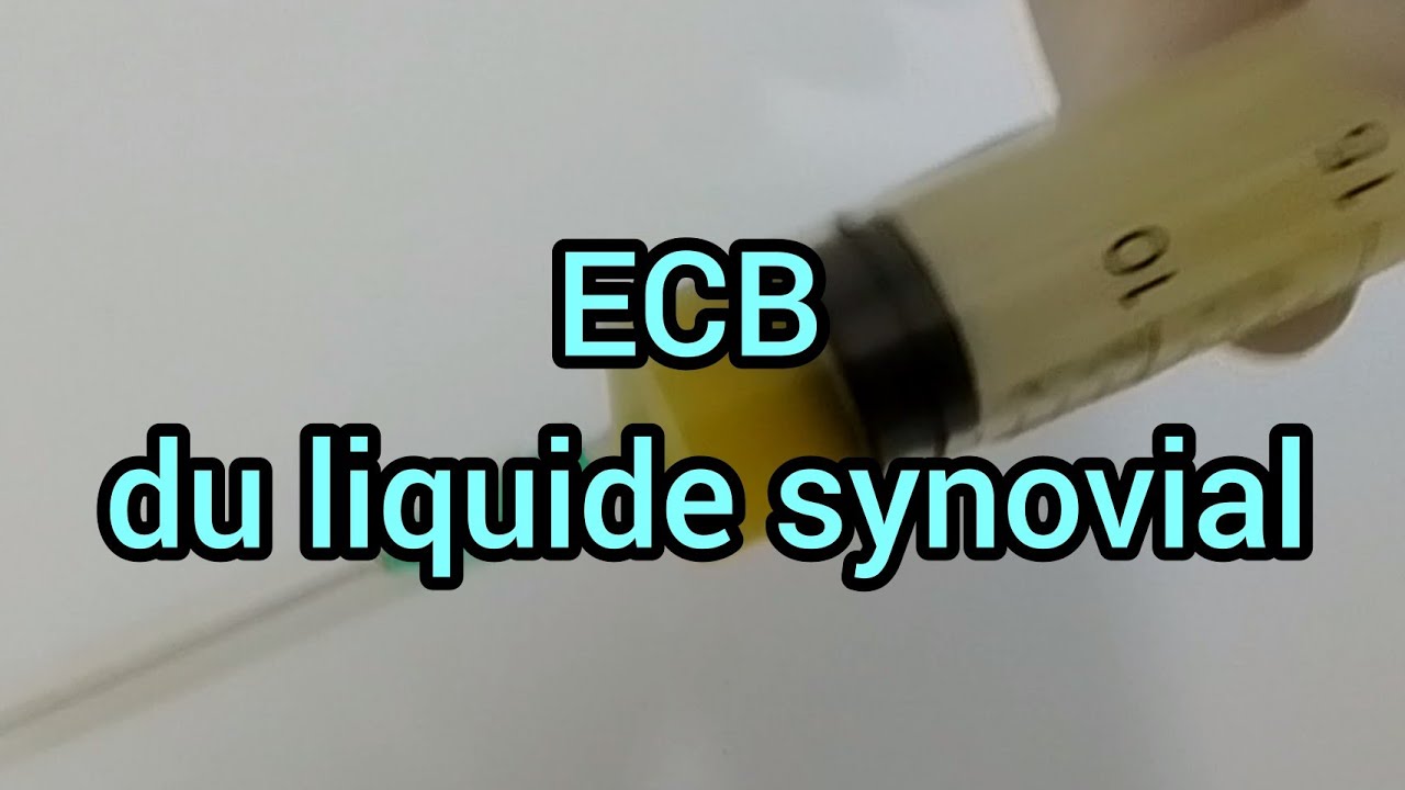Examen cytobacteriologique du liquide synovial. liquide articulaire ...