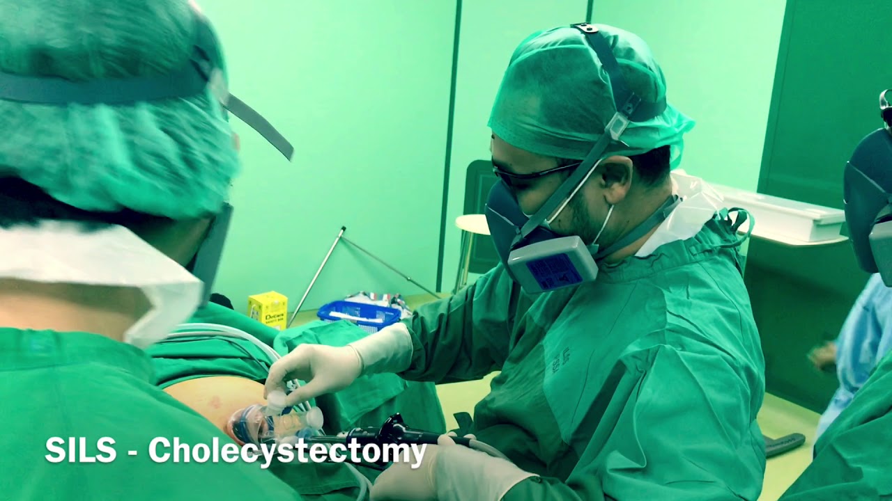 BEDAH MALANG | SILS - CHOLECYSTECTOMY | DR. DWICHA RAHMAWANSA S ,SP.B ...