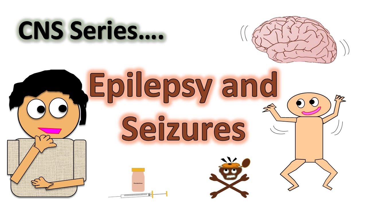 Epilepsy and Seizures | subtle,focal,myoclonic seizures |# CNS Series ...