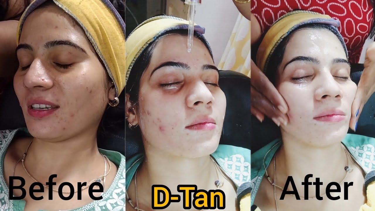 Different types of D-Tan. Tanning remove magical cream & serum 💯 ...