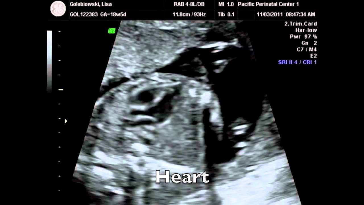 Amazing Baby Ultrasound at 18 weeks - YouTube