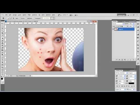 cara menghilangkan jerawat di photoshop by awalin anhar
